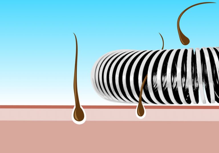 How does the Epilady work? - Epilady New Zealand